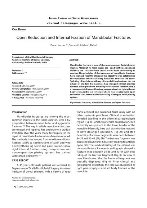 Pdf Open Reduction And Internal Fixation Of Mandibular Fracturescalled Ideal Line Of