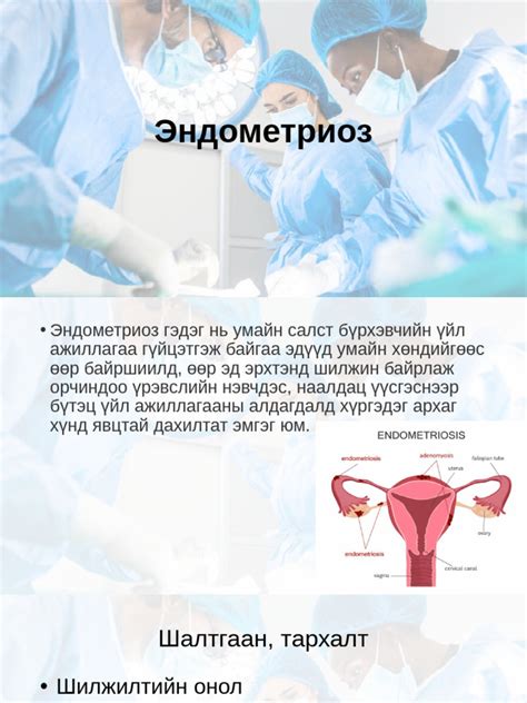 Эндометриоз Pdf