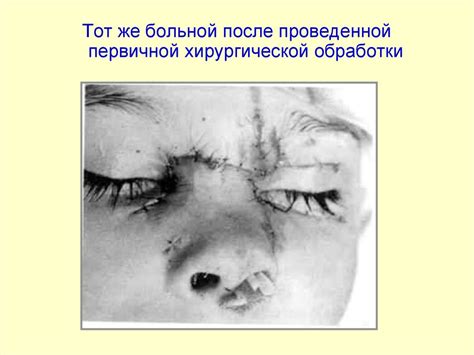 Травмы органов и тканей челюстно лицевой области у детей презентация онлайн