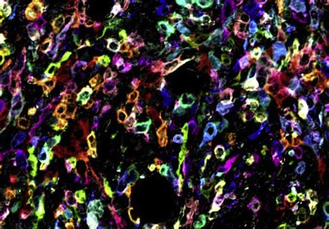 A Colorful New Approach To Identifying Regulators Of The Tumor Microenvironment Physicians