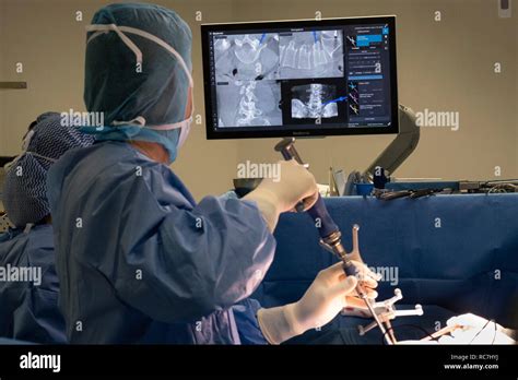 Doctor Looking At The Neuronavigation Computer Assisted Technology