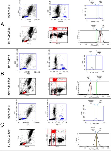 Hla B27 Antigen Vs Dna Typing At Sally Esterly Blog
