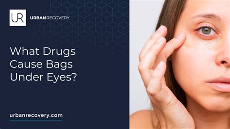 What Drugs Cause Bags Under Eyes