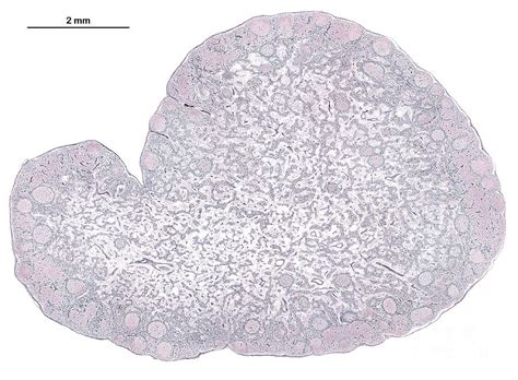Reticular Fibres In Lymph Node Photograph By Jose Calvo Science Photo Library Pixels