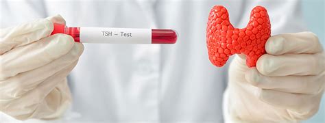 Thyroid Function Testing And Thyroid Nodules Ceei