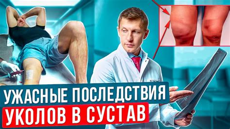 Никогда не делайте укол в сустав Кому точно не поможет укол