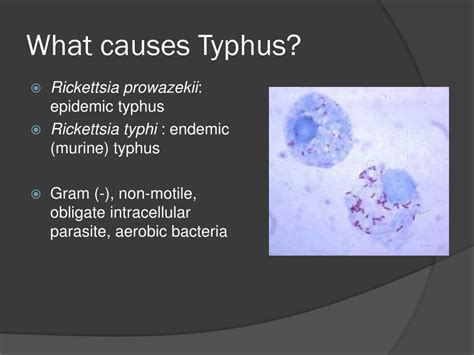 Ppt Typhus By Tim Waer Powerpoint Presentation Free Download Id