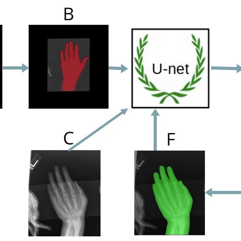Iterative Procedure Of Positive Mining Utilizing U Net Architecture For