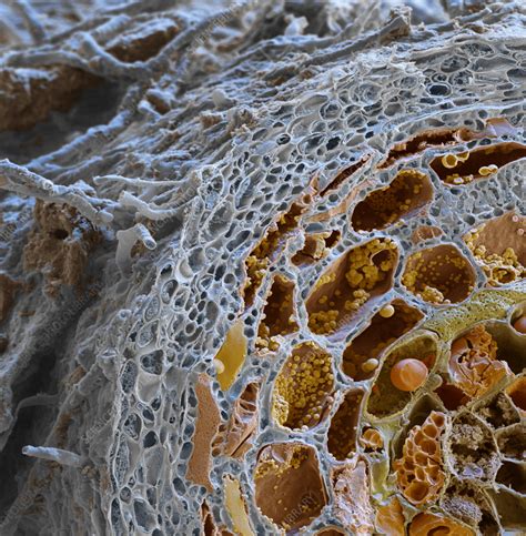 Plant Root With Ectomycorrhiza Sem Stock Image C057 4190 Science