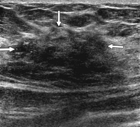 Architectural Distortion At Savannah Mccarthy Blog