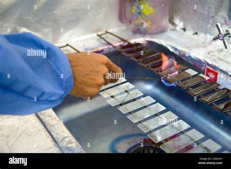 Tuberculosis Tb Testing Hi Res Stock Photography And Images Alamy