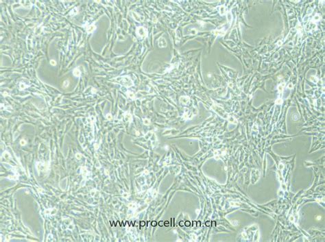 Nci H1975（人肺腺癌细胞） 细胞系 武汉普诺赛生命科技有限公司