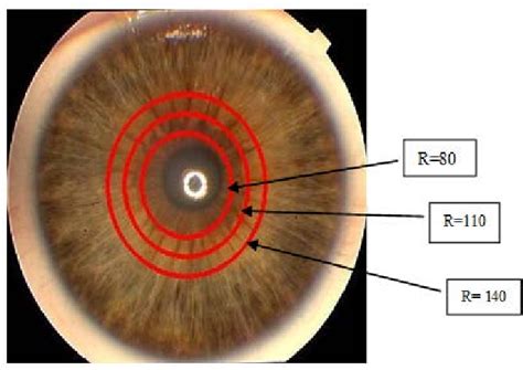 Figure 1 From Pupil Detection Based On Color Difference And Circular