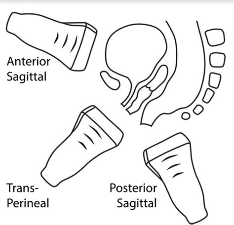 Illustration Shows The Different Transducer Placements That Facilitate Download Scientific