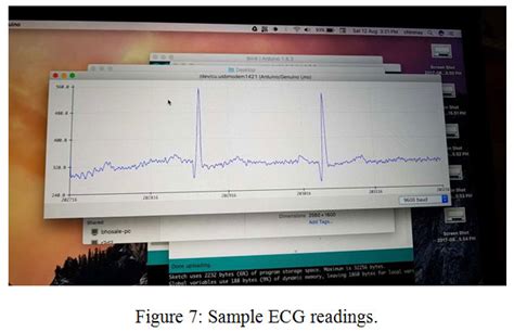 Healthcare Monitoring System Based On Wireless Sensor Network For Cardiac Patients Biomedical