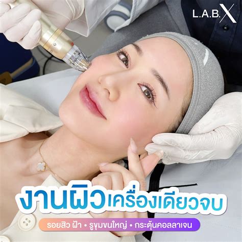 Labx Laser Center เลเซอร์ Pico หน้าใส หลุมสิว ฝ้า กระ Nonthaburi