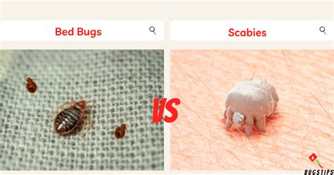 Bed Bugs Vs Scabies 5 Key Differences And Similarities With Easy Prevention Bugstips