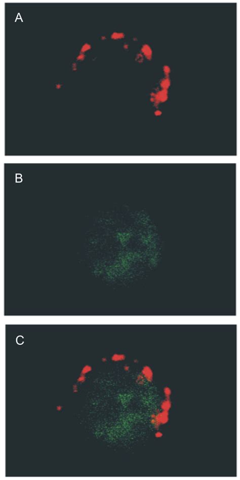Confocal Microscopy Of Dc After Internalization Of Cfda Labelled A20 Download Scientific