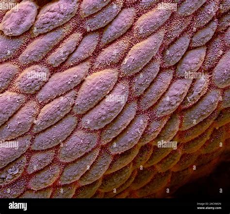 Colon Coloured Scanning Electron Micrograph Sem Of The Surface Of The Human Colon Absorptive