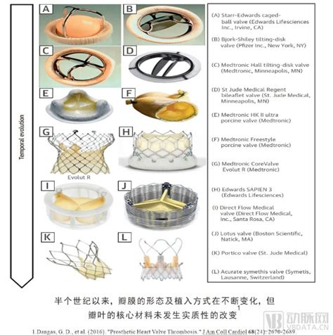 首发高分子瓣膜企业心锐医疗完成超千万元天使轮融资北极光创投独家投资 财富号 东方财富网