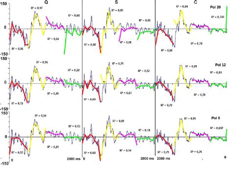 Polynomial Regression Red Calculated For Different And