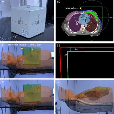 Comparison Between The Cone Beam Ct Cbct And Simulation Ct Of The Download Scientific Diagram