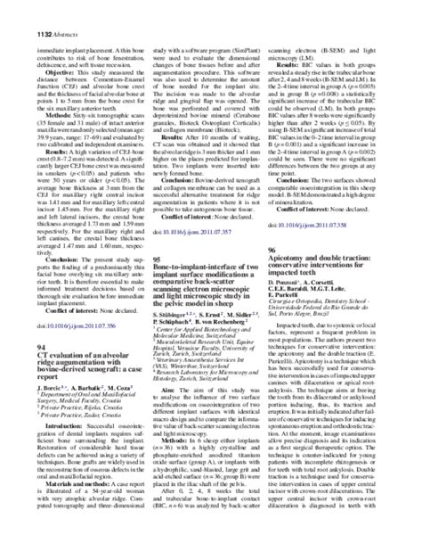 Apicotomy And Double Traction Conservative Interventions For Impacted Teeth