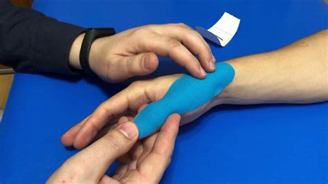 Наложение кинезио тейпа на длинный разгибатель большого пальца кисти Youtube