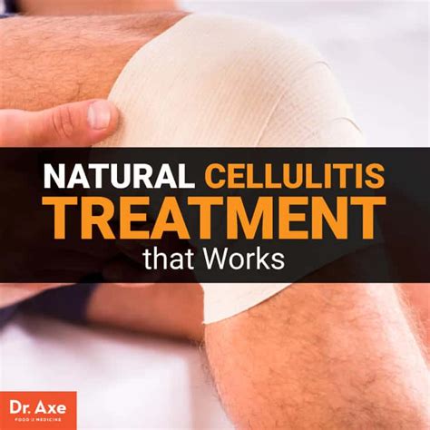Cellulitis Treatment Natural Remedies And Prevention Tips Dr Axe