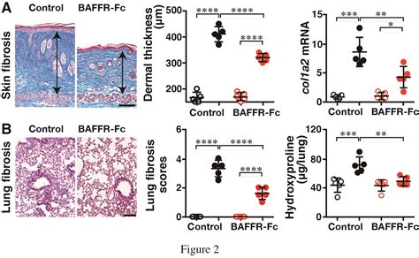 Baff Inhibition Attenuates Fibrosis In Bleomycin Induced Scleroderma Model Via Modulating The