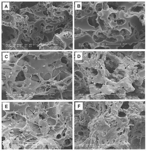 Scanning Electron Micrograph Sem Of Poly Glycerol Sebacate Pgs Download Scientific Diagram