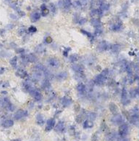 Cell Cluster Segmentation Orbit