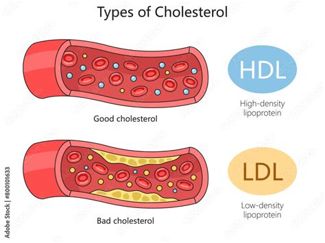 HDL Good Cholesterol And LDL Bad Cholesterol In Blood Vessels For