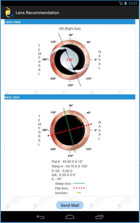 Toric Iol Calculator Apk For Android Download