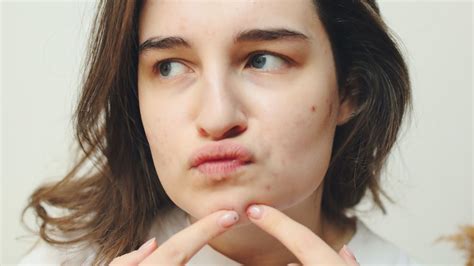 Why Is Pimple Popping So Addicting Fazit