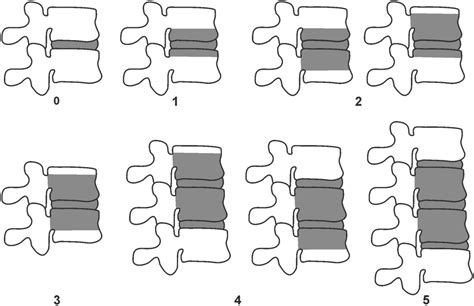 Illustrations Of Od Classification Grades 0 To 5 Corresponding To