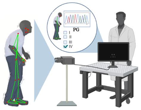 Sensors Free Full Text A Vision Based System For Stage Classification Of Parkinsonian Gait