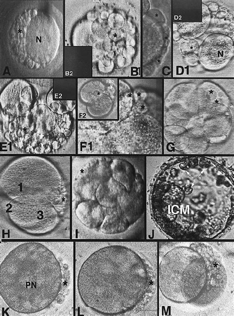 Egg Cell Division Microscope