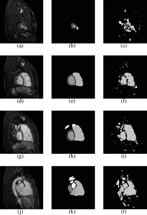 Figure 1 From Unsupervised And Fully Autonomous 3d Medical Image