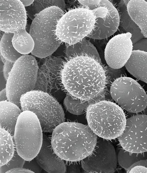 Yeast Fungus Cryptococcus Festucosus By Science Photo Library