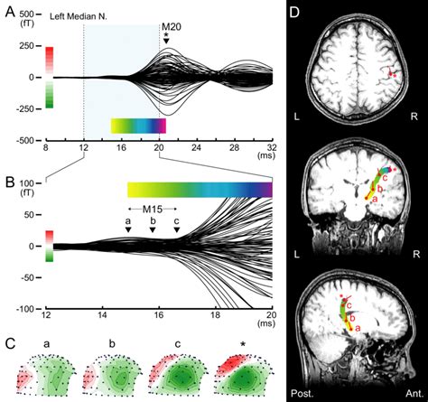 Somatosensory Magnetic Fields Following Left Median Nerve Stimulation
