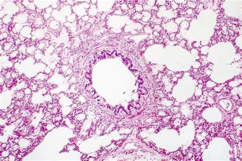 Corte Transversal Del Tejido Pulmonar Humano Que Muestra Los