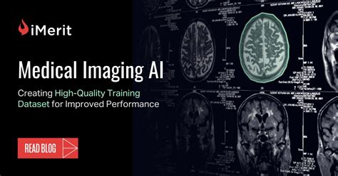 Imerit Technology On Linkedin Medical Imaging Ai Creating High Quality Training Dataset For