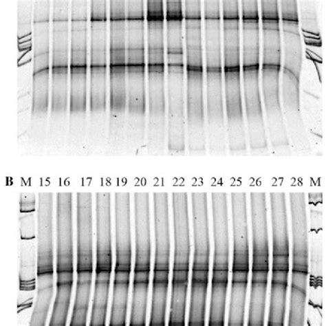 Dgge Patterns Obtained With Pcr Dgge Based On 16s Rrna Gene In Response Download Scientific