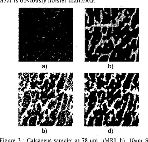 Figure 3 From Bone Mri Segmentation Assessment Based On Synchrotron Radiation Computed