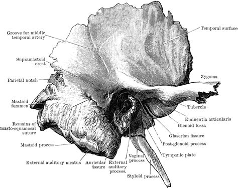 6 Temporal Bone Ranzcrpart1 Wiki Fandom Powered By Wikia