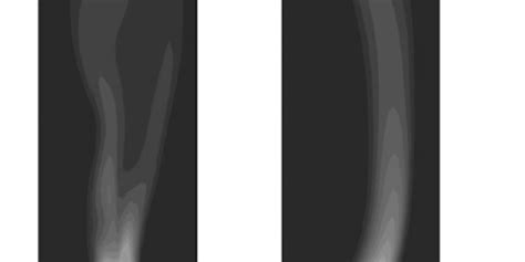 A Detached Eddy Simulation Approach Cfd Simulations Fetchcfd