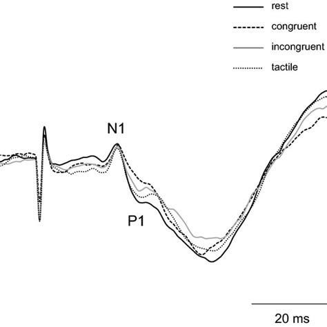 Grand Averaged Waveforms Of Somatosensory Evoked Potentials Seps Download Scientific Diagram