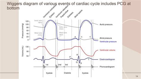 Phonocardiogrampptx Heart And Cardiovascular Diseases Diseases And