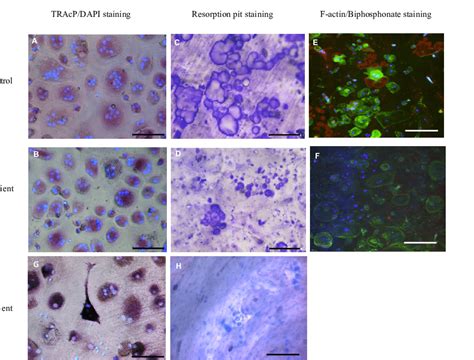 Osteoclast Cultures Osteoclasts Were Generated From Cd14 Cells With Download Scientific